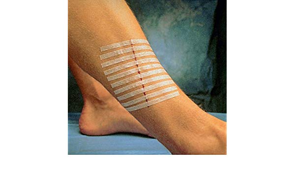 Leukostrip & Leukostrip S - wondhechtstrips - Van Houdt Medical